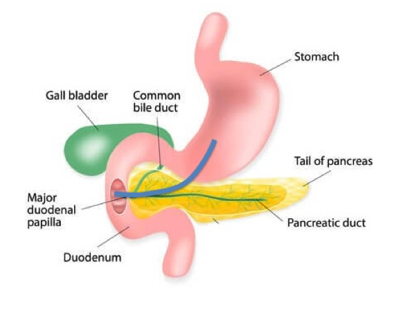 Therapeutic Endosonography | Advanced Endoscopy Services | RWJ ...