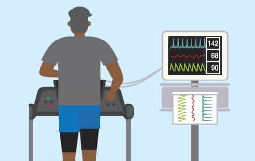 Fast Facts About Cardiac Stress Tests